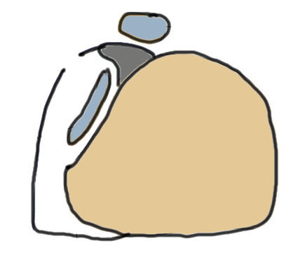 Subluxation / Dislocation | The Bone School